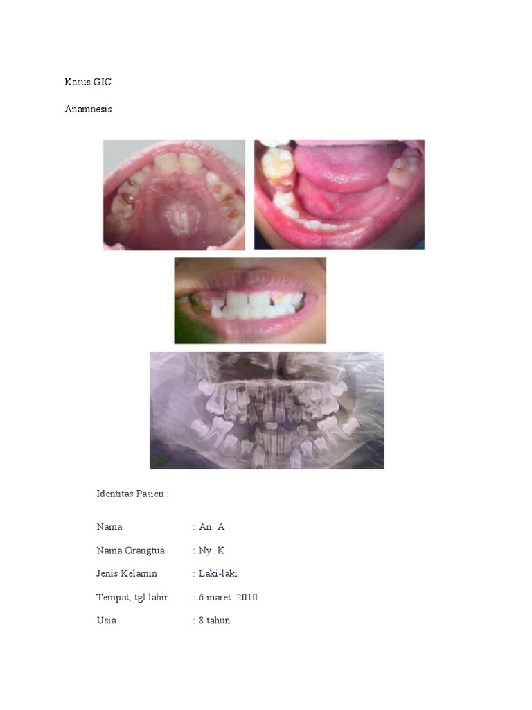 Kasus GIC Anamnesis | PDF