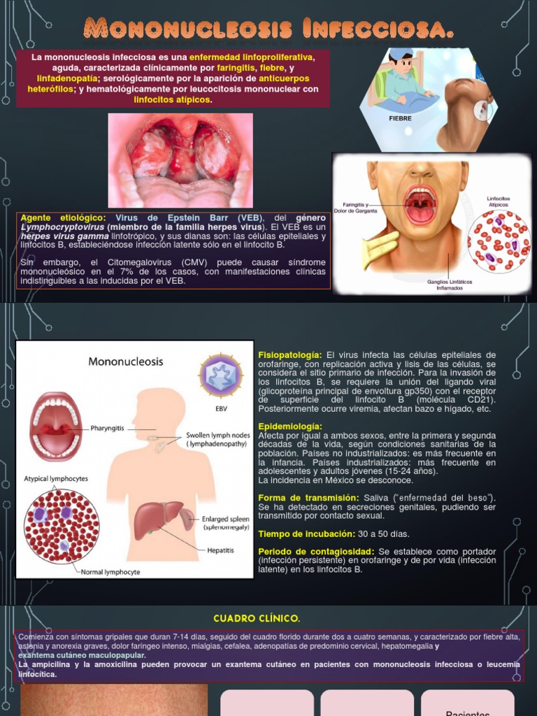Mononucleosis: Guía y Tratamiento | PDF | Enfermedades y trastornos | Especialidades Medicas