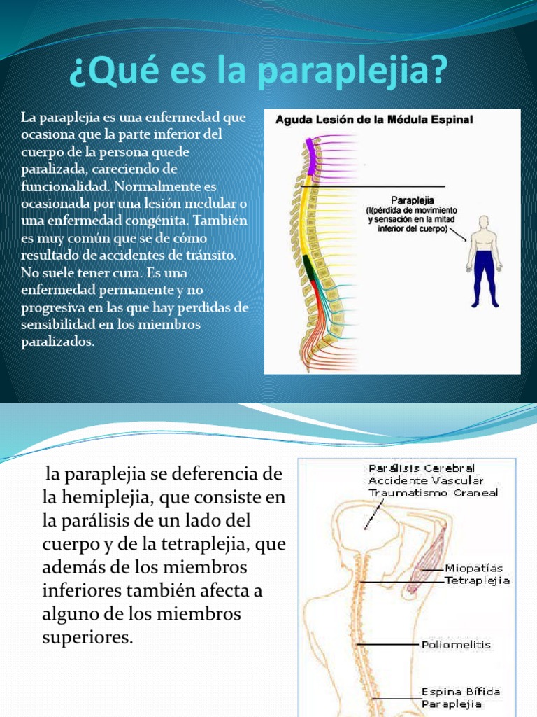 Paraplejia | PDF | Medicina CLINICA | Enfermedades y trastornos