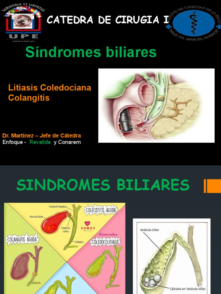 Litiasis Coledociana - Colangitis - 1 | PDF | Vesícula biliar | Sistema ...