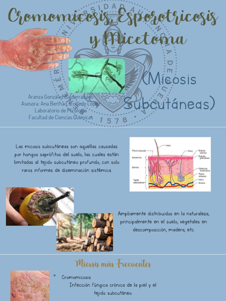 Practica 8 Micosis Subcutáneas (Cromomicosis, Esporotricosis y Micetoma ...