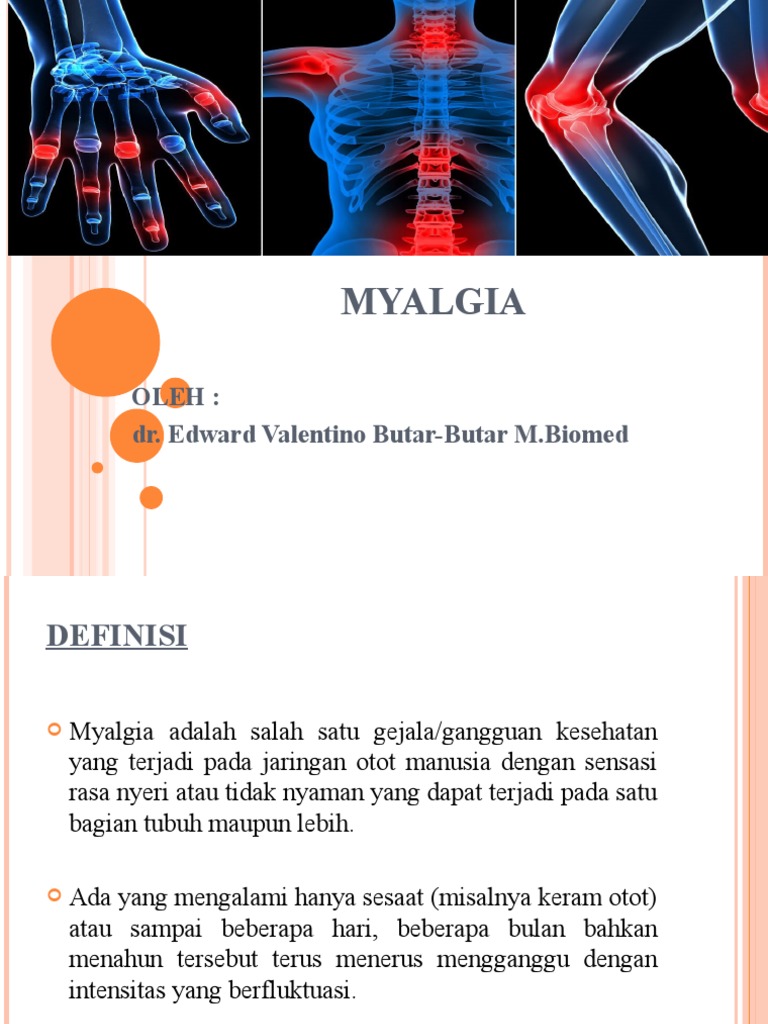 Myalgia | PDF