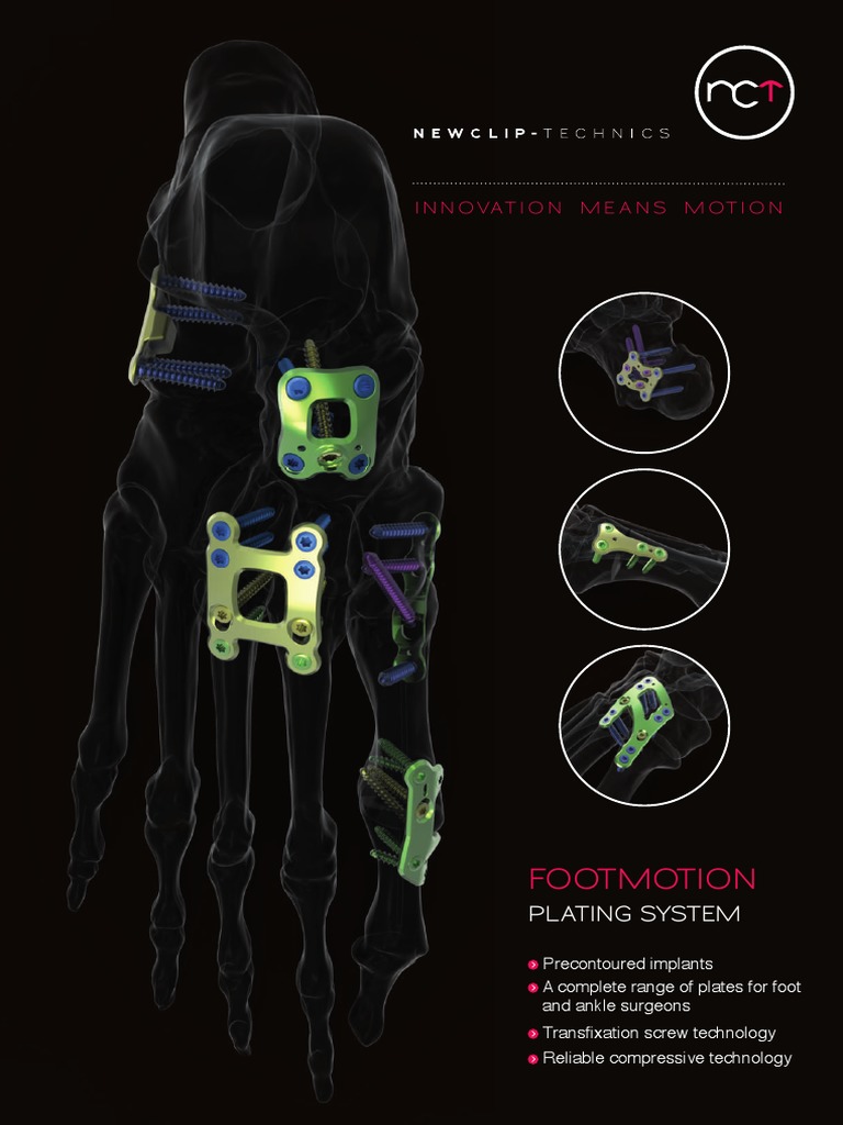 Footmotion Plating System en | PDF | Foot | Screw