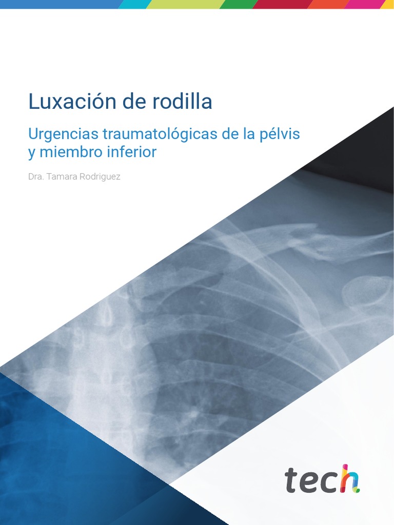 Luxacion de Rodilla | PDF | Rodilla | Especialidades Medicas