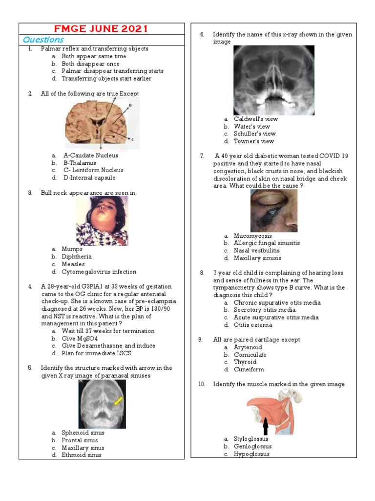 Fmge June 2021: Questions | PDF | Cataract | Anemia