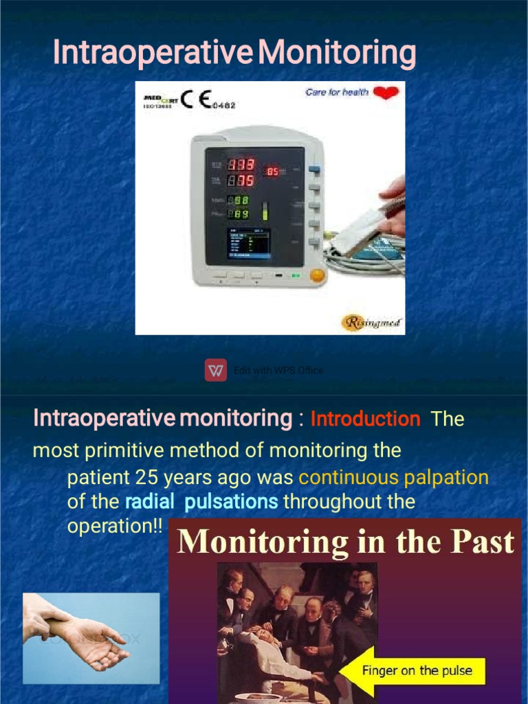 Intraoperativemonitoring | PDF | Blood Pressure | Electrocardiography