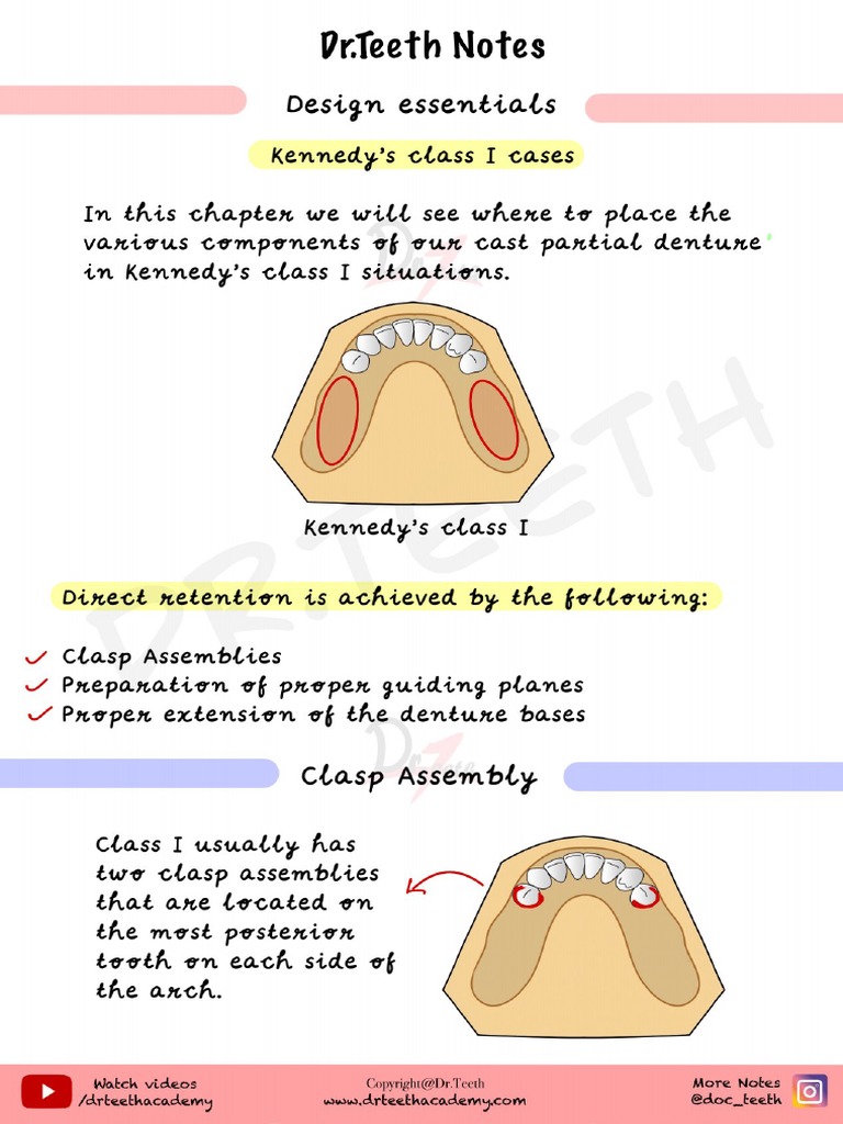 Designing of Cast Partial Dentures | PDF