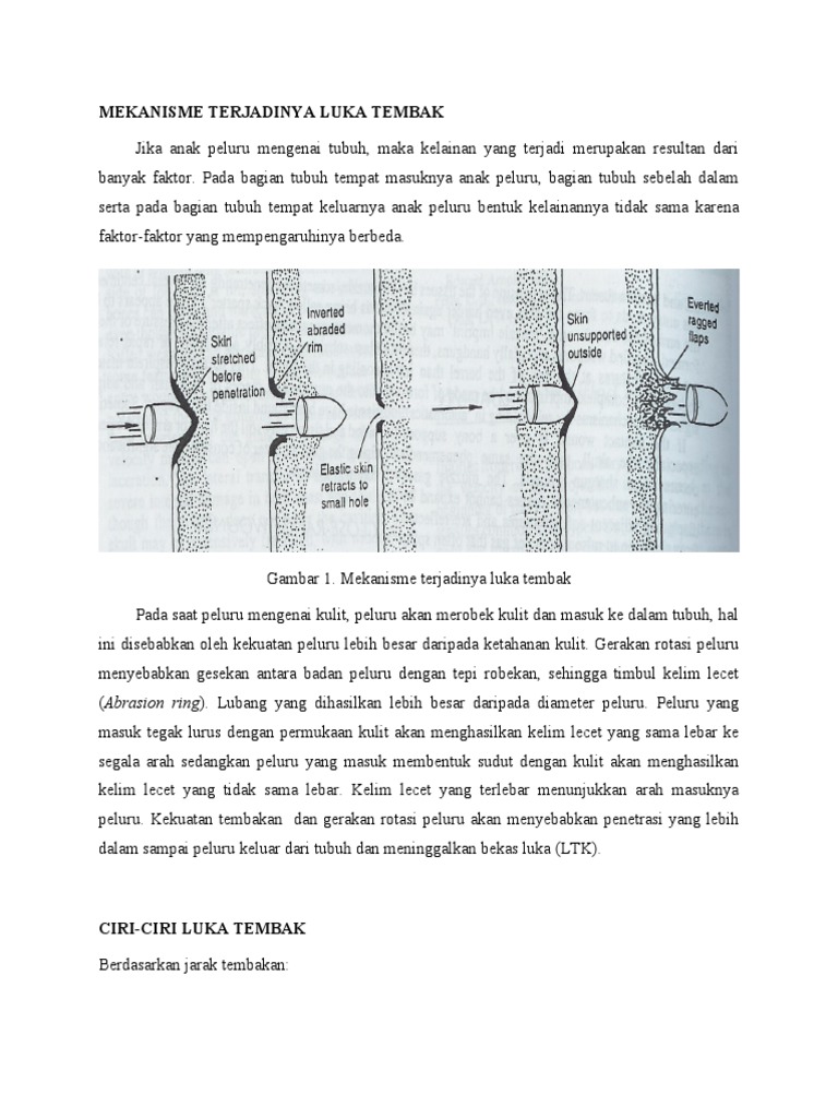 Mekanisme Terjadinya Luka Tembak | PDF