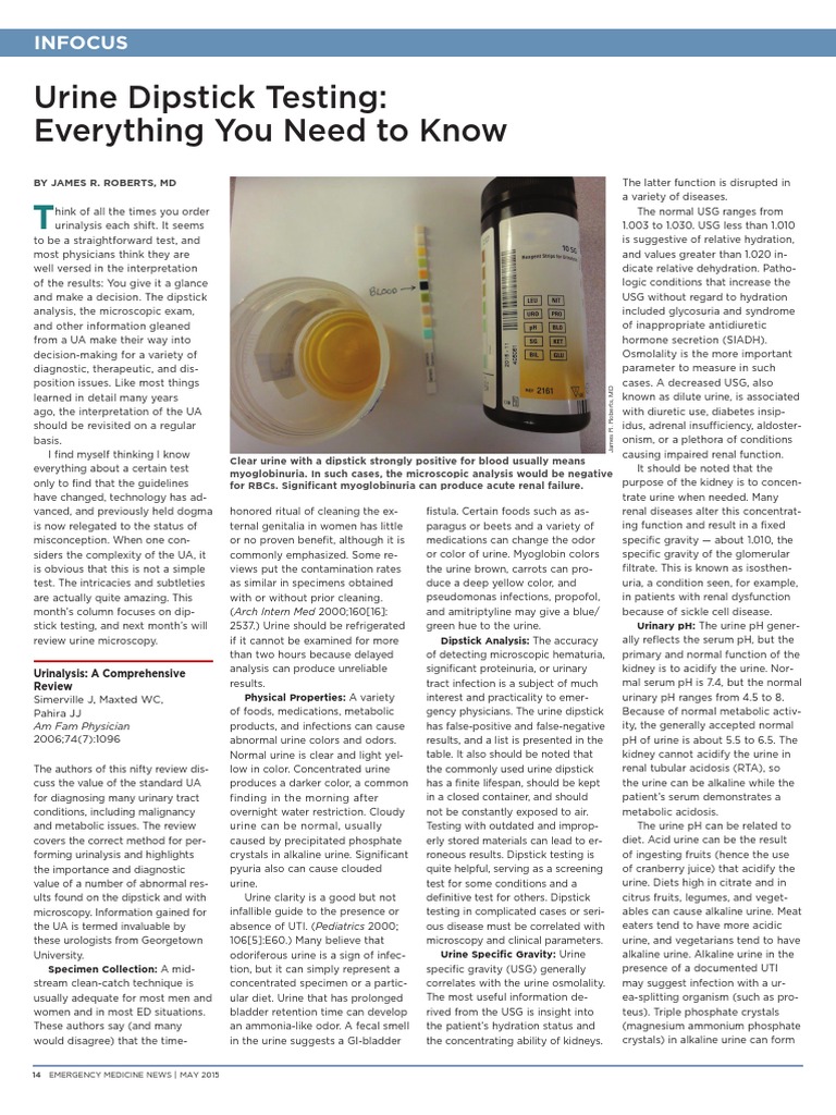 Urine Dipstick Testing: Everything You Need To Know: Infocus | PDF ...