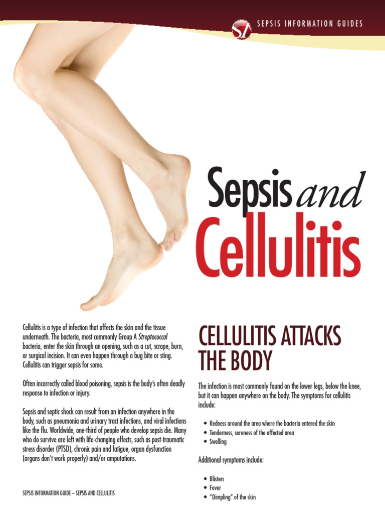 Sepsis and Cellulitis | Download Free PDF | Sepsis | Diseases And Disorders