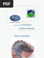 Boton de Nance | PDF | Ortodoncia | Odontología