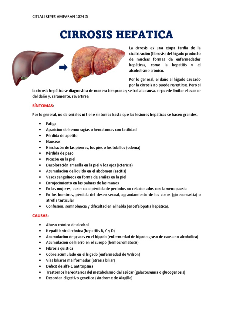Cirrosis Hepatica y Carcinoma Hepatocelular | PDF | Cirrosis | Hepatitis C