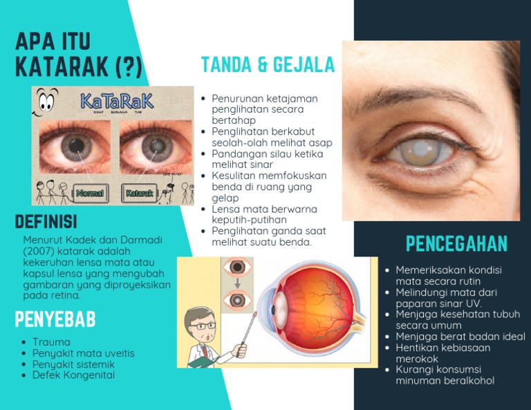 Leaflet Penyakit Katarak | PDF