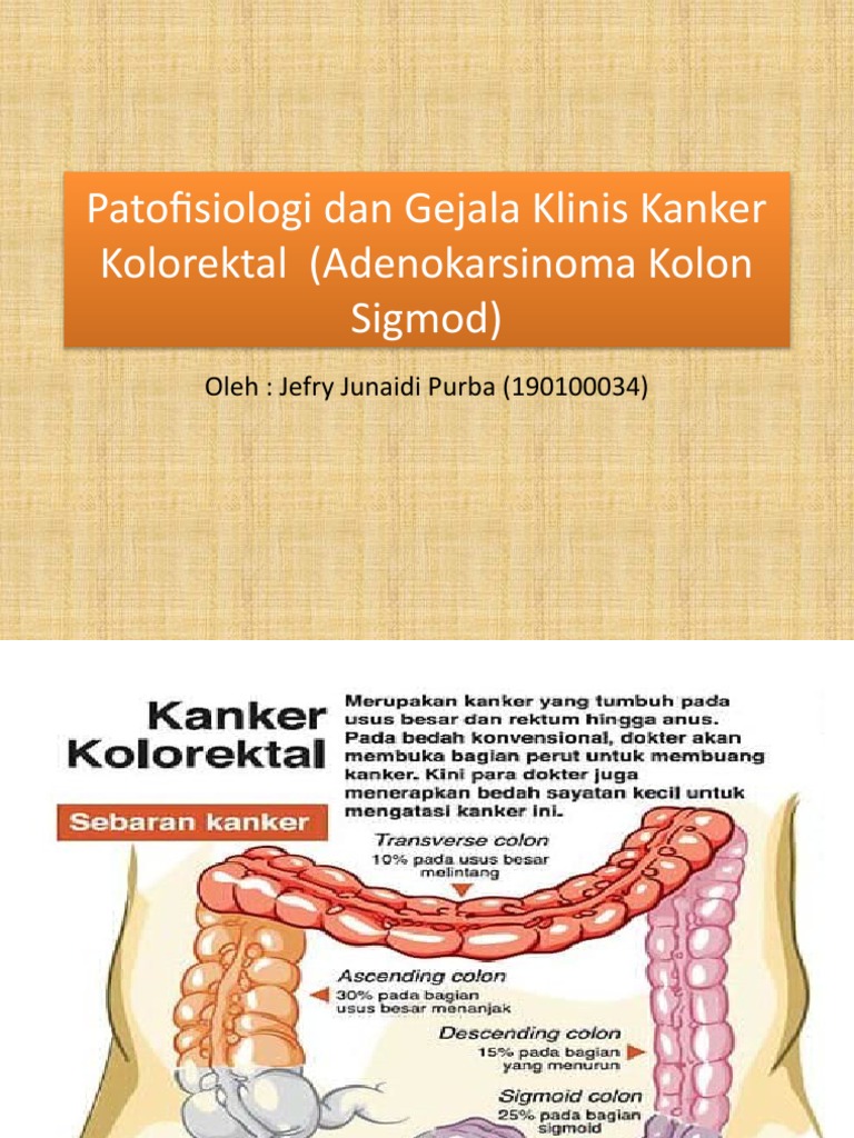 LI-7 - Patofisiologi Dan Gejala Klinis Kanker Kolorektal ...