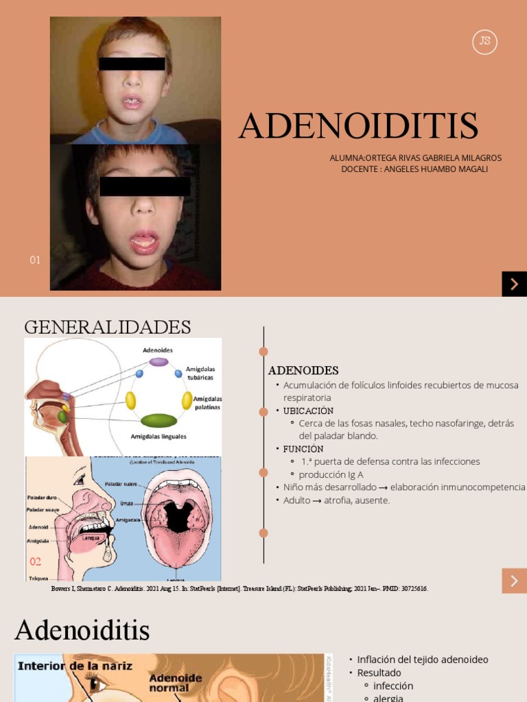 Adenoiditis | PDF | Enfermedades y trastornos | Epidemiología