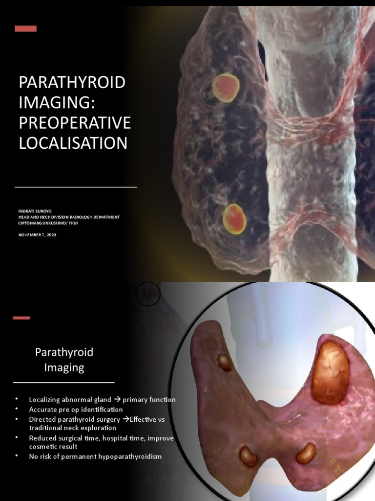 Parathyroid Imaging - Preoperative Localisation Designed Final | PDF ...