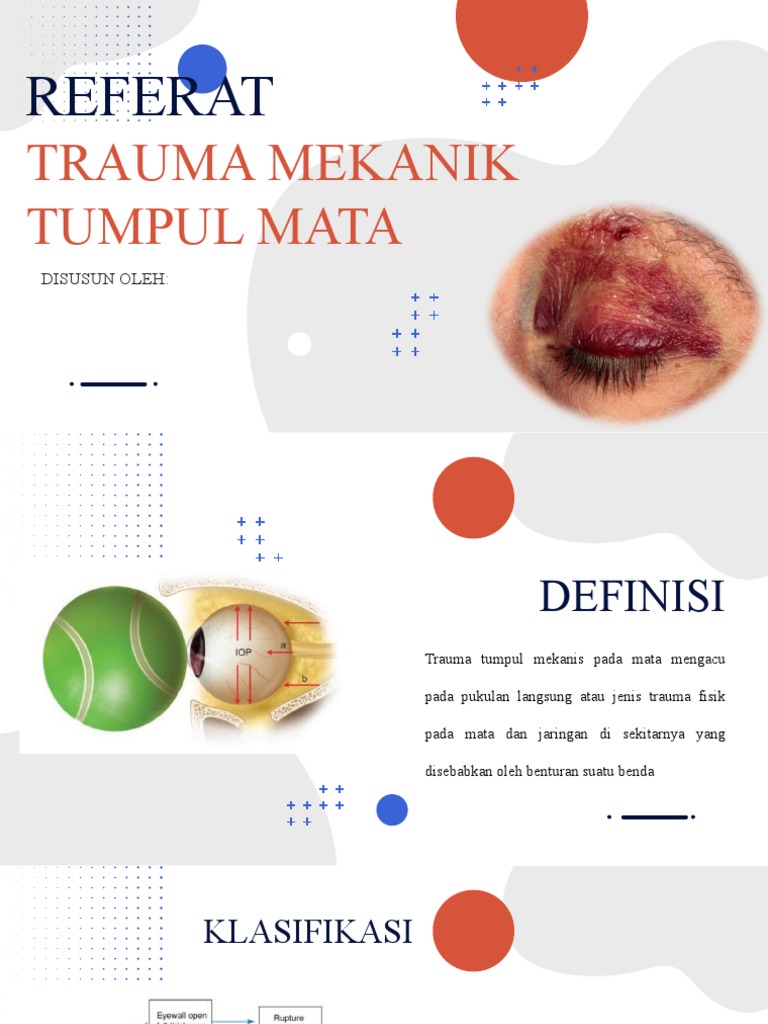 Referat Trauma Mata | PDF