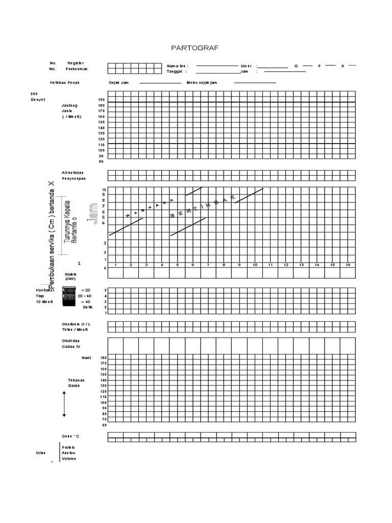 Partograf | PDF