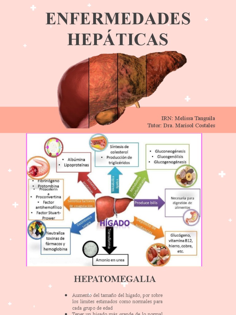 Enfermedades Hepáticas y Recomendaciones | PDF | Hepatitis | Cirrosis