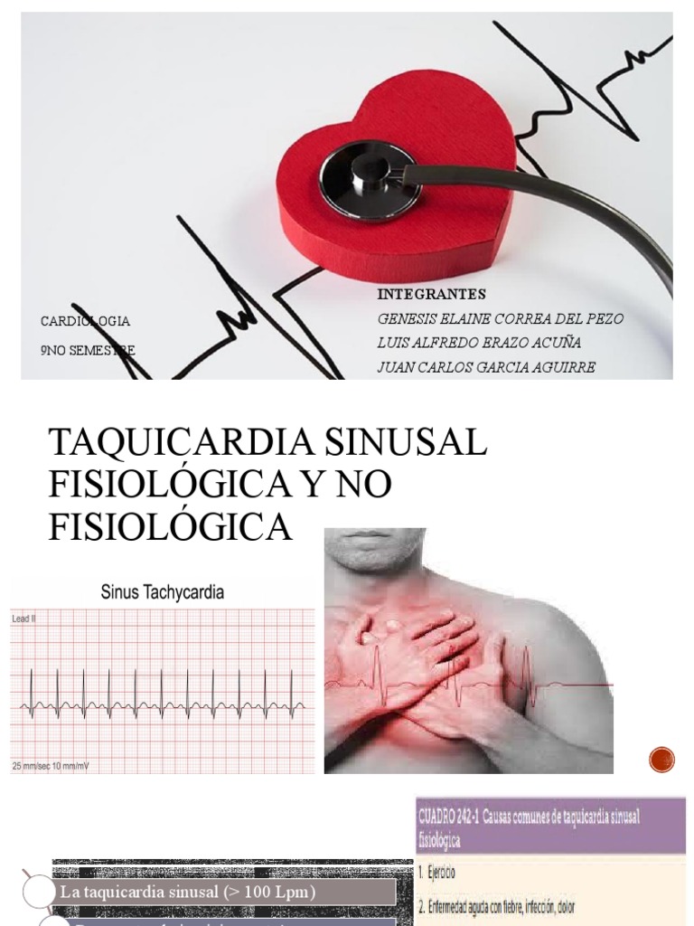 Taquicardia Sinusal - Arritmias Ventriculares | PDF | Electrofisiología ...