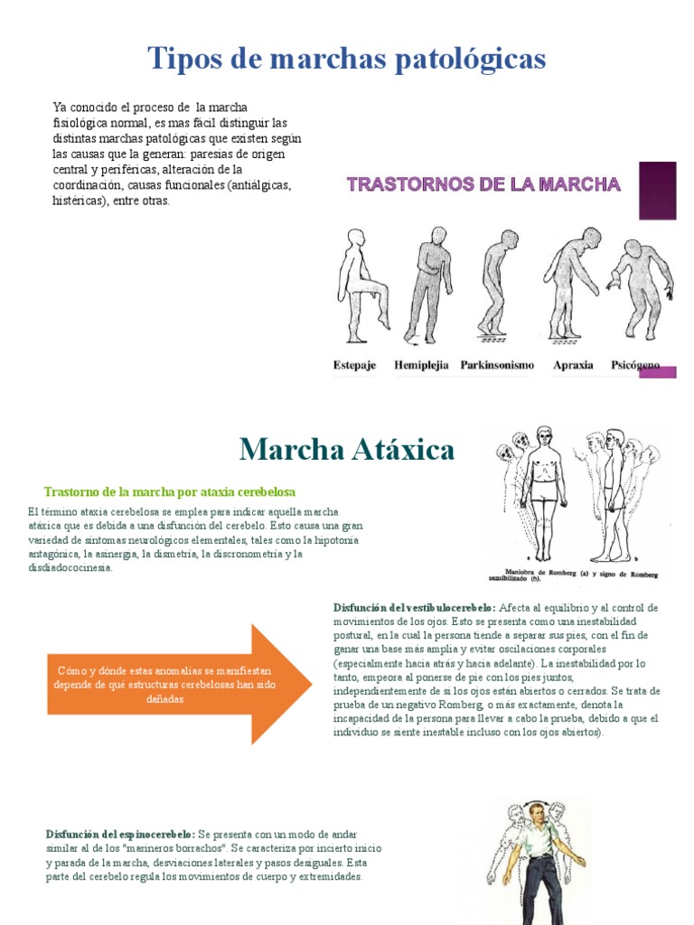 Marcha Atáxica