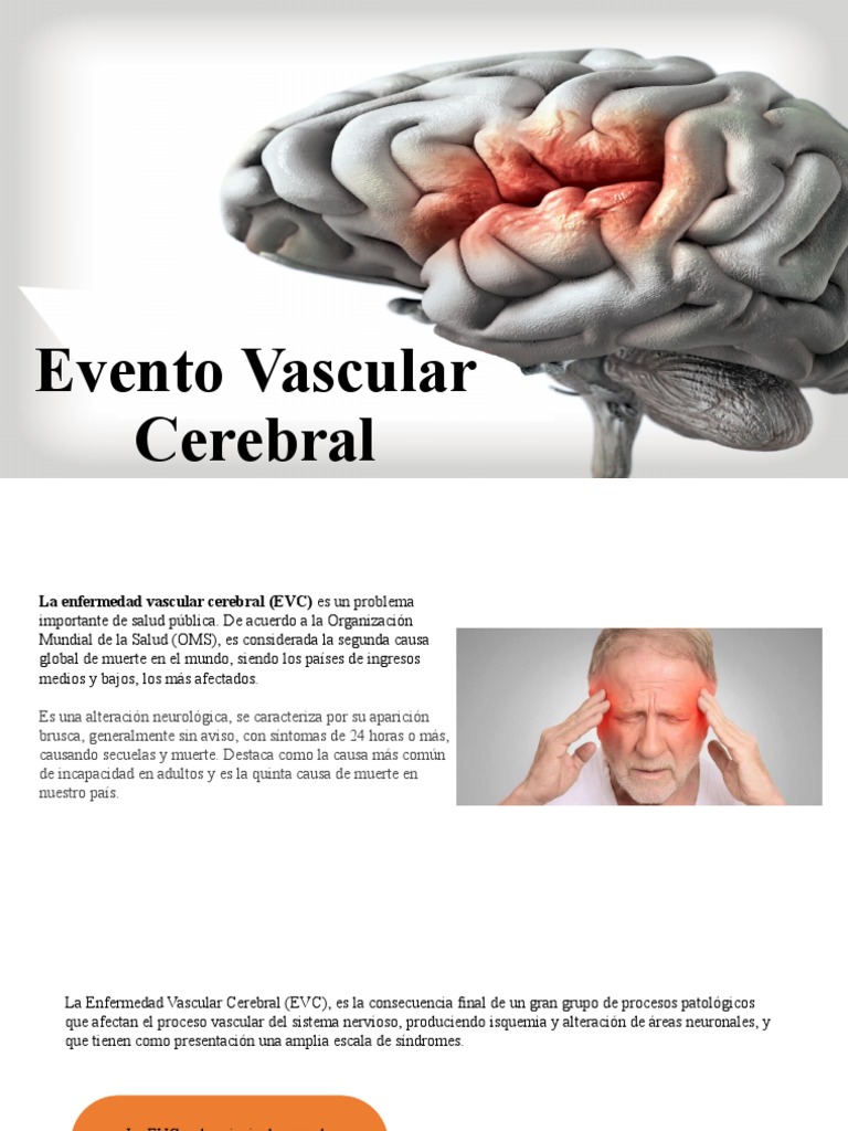 Evento Vascular Cerebral | PDF | Carrera | Isquemia