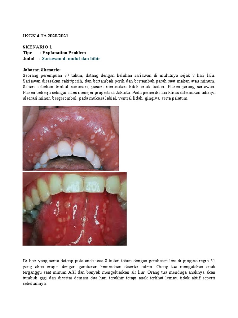 SK1 IKGK4 2021 Reguler | PDF