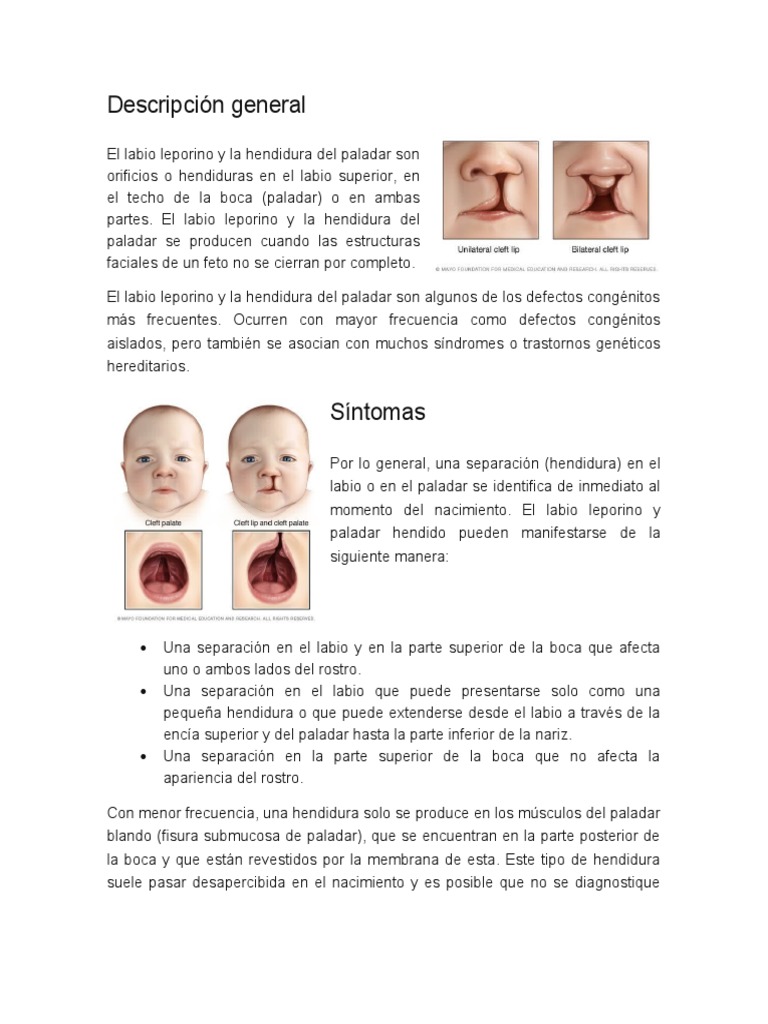 Labio Leporino y Hendidura del Paladar | PDF | Ciencias de la Salud ...