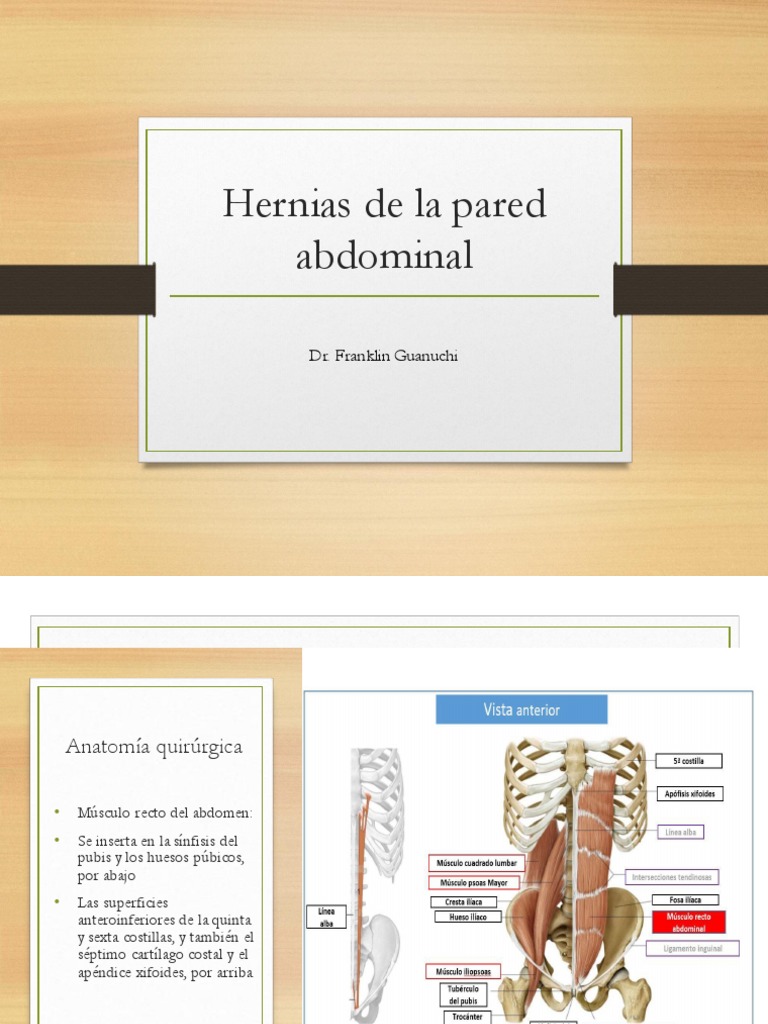 Hernias de La Pared Abdominal | PDF | Abdomen | Sistema musculoesquelético