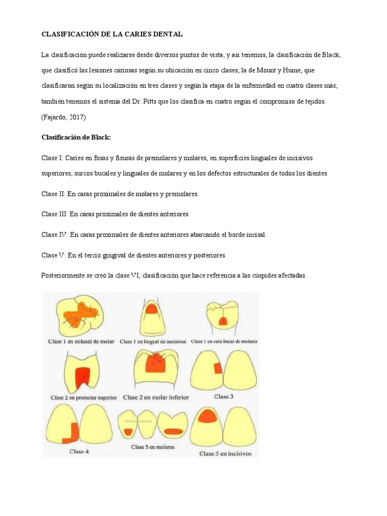 Clasificación de La Caries Dental | PDF | Diente | Esmalte de dientes
