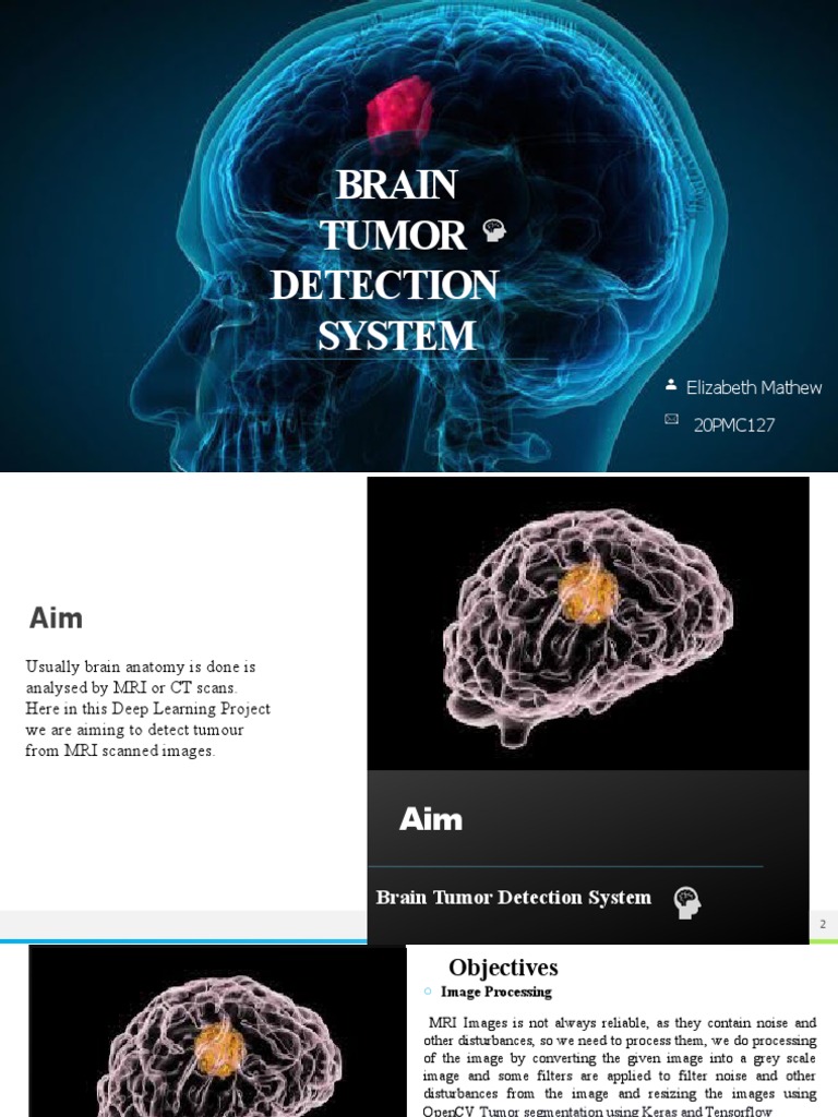 Brain Tumor Detection Abstract | PDF | Deep Learning | Neuroscience