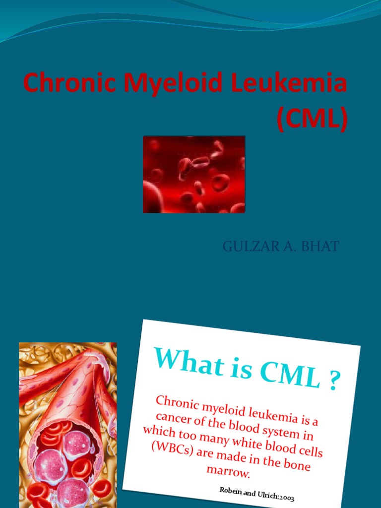 Chronic Myeloid Leukemia (CML) : Gulzar A. Bhat | PDF | Cell Nucleus ...