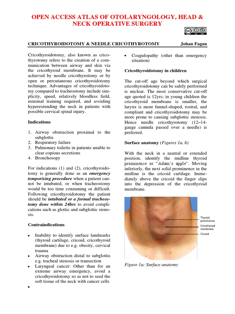 Cricothyroidotomy and Needle Cricothyrotomy | PDF | Larynx ...