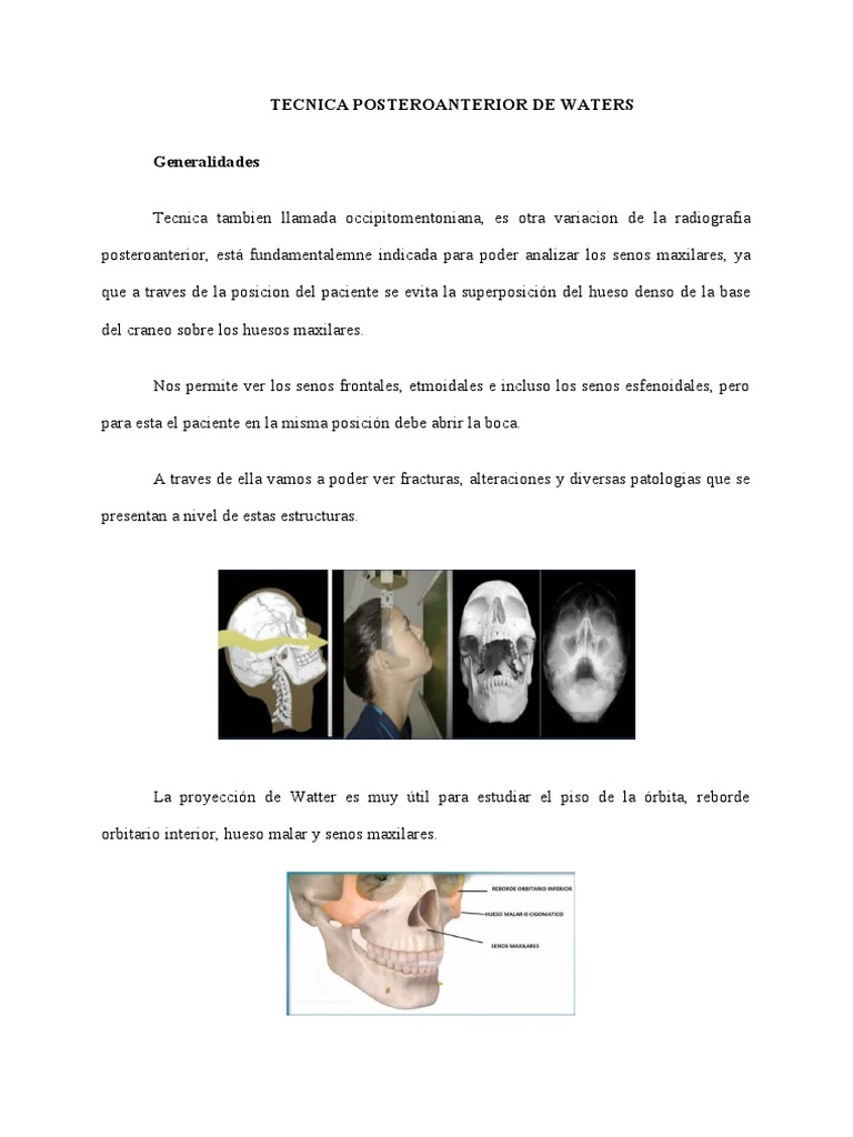 Tecnica Posteroanterior de Waters | Descargar gratis PDF | Sistema ...