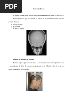 Proyección Hirtz para Cráneo | PDF