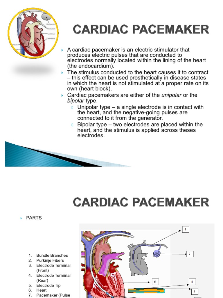 An Overview of Cardiac Pacemaker Types, Components, and Functioning | PDF