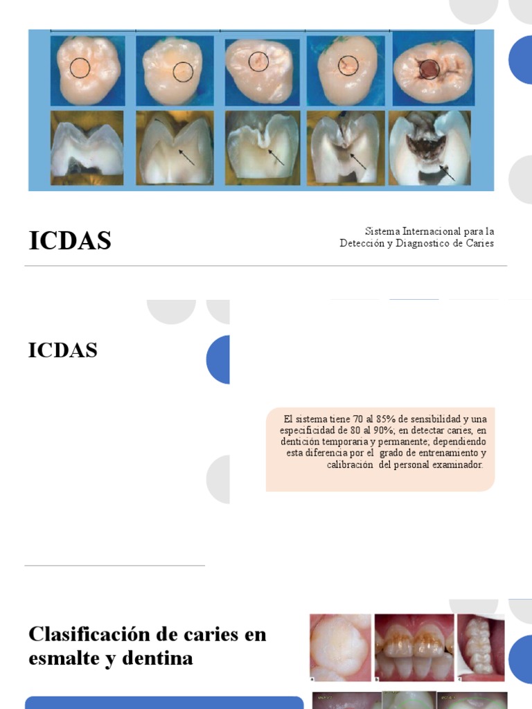 ICDAS | PDF | Diente | Esmalte de dientes