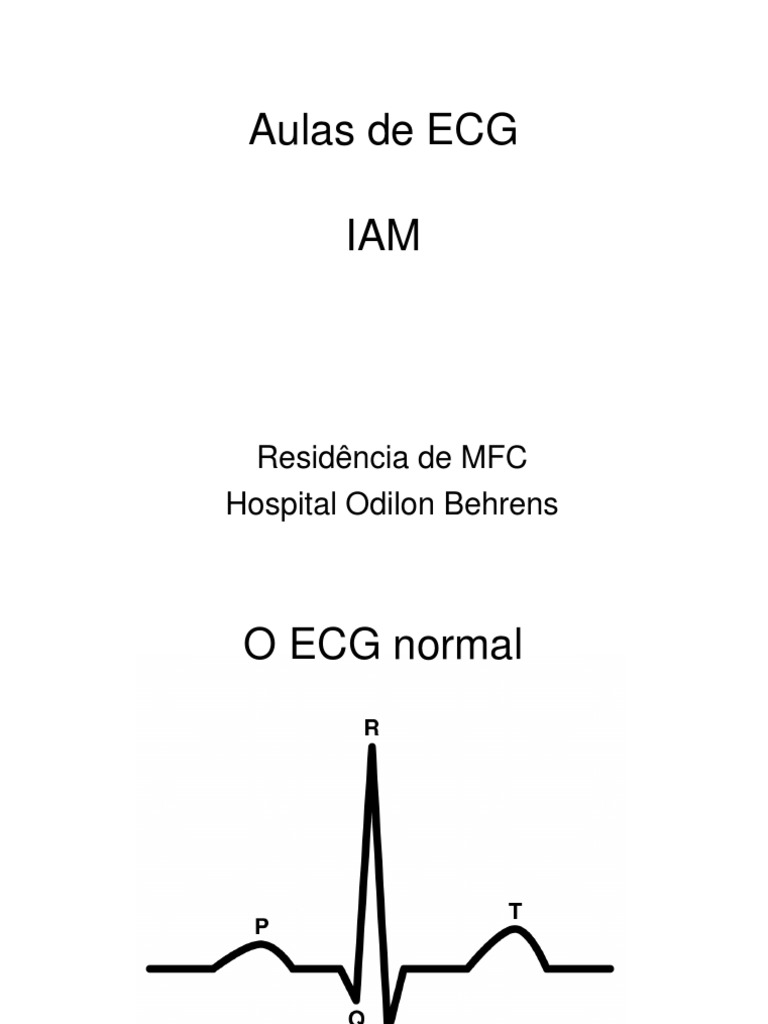 ECG IAM Parte 1 | PDF | Infarto do Miocárdio | Eletrocardiografia