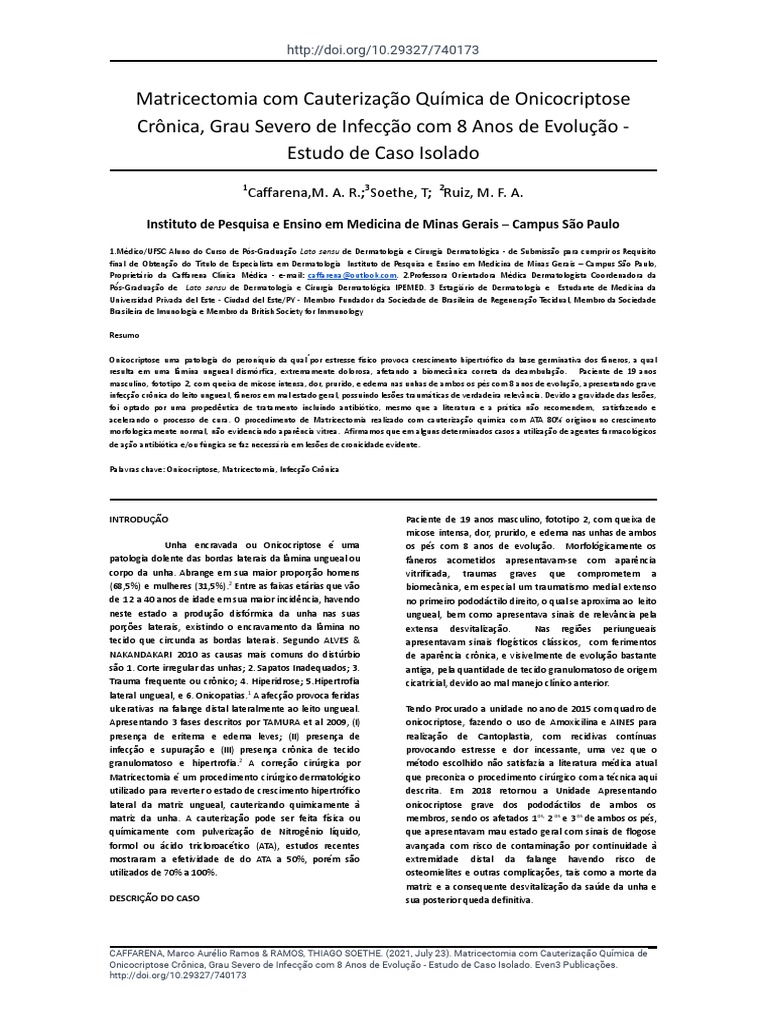 Matricectomia Com Cauterização Química de Onicocriptose Crônica, Grau ...
