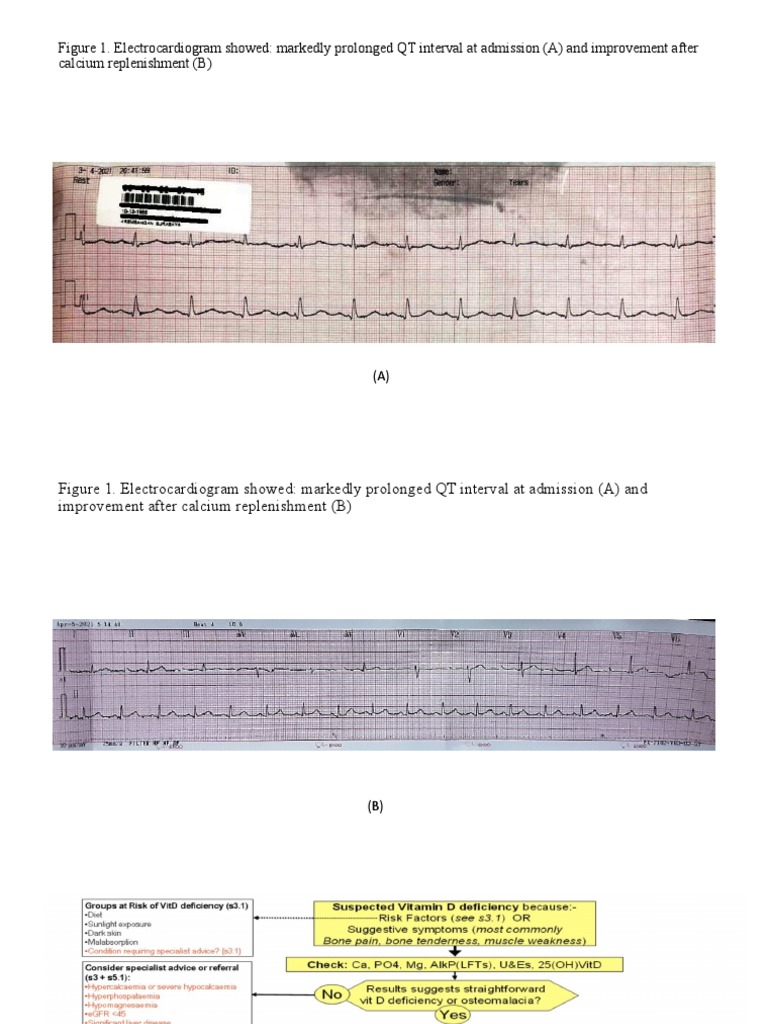 Figure 1. Electrocardiogram Showed: Markedly Prolonged QT Interval at ...
