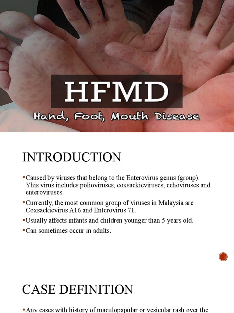 Comprehensive Guide to Hand, Foot and Mouth Disease: Transmission ...