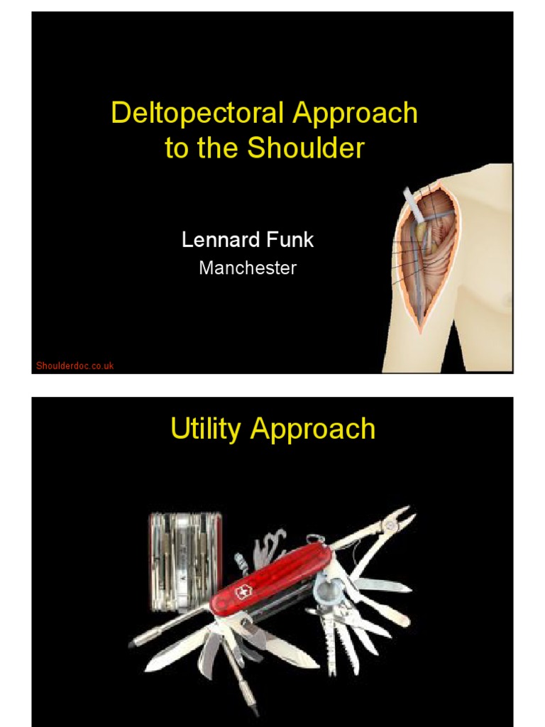 Deltopectoral Approach To The Shoulder: Lennard Funk | PDF | Shoulder ...
