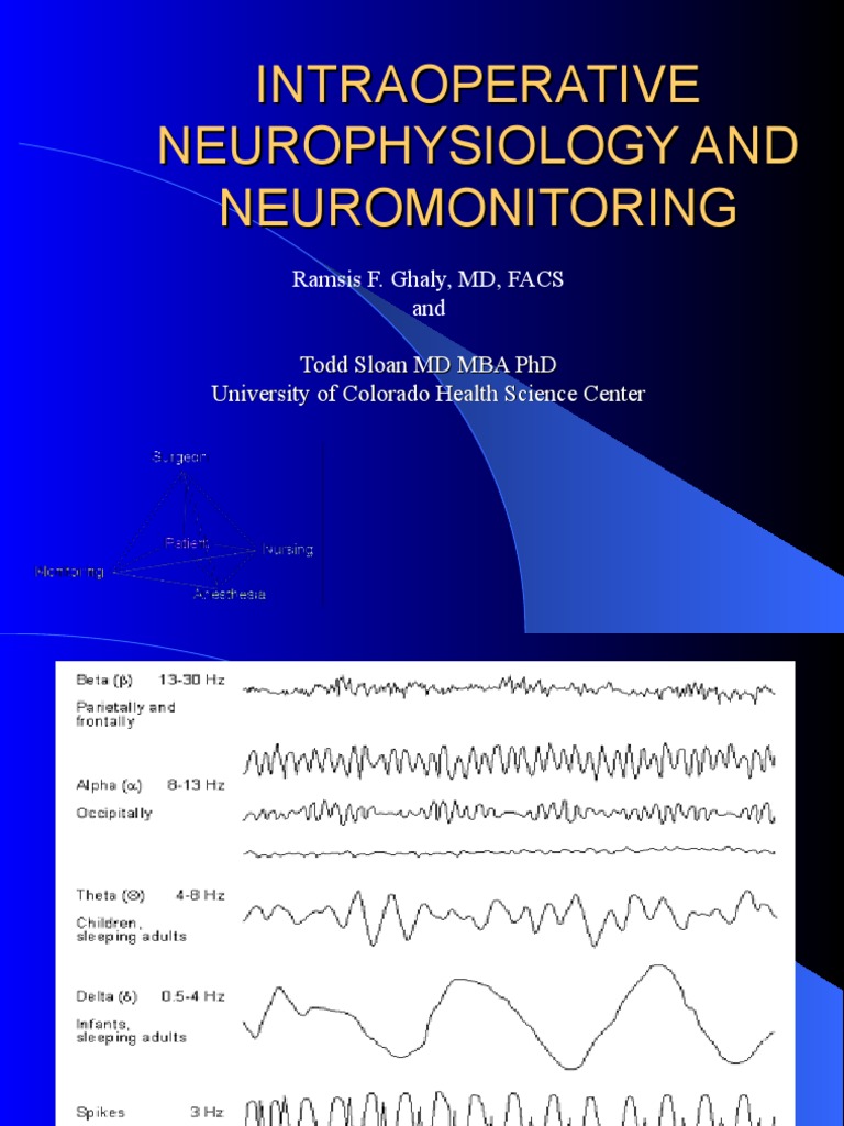 Intraop Neurophysiology Monitoringhandout | PDF ...