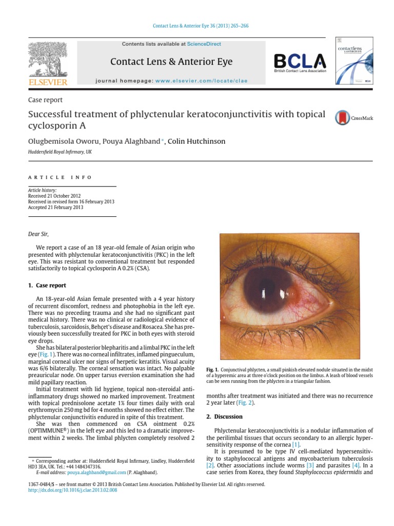 Jurnal - INF - Successful Treatment of Phlyctenular ...