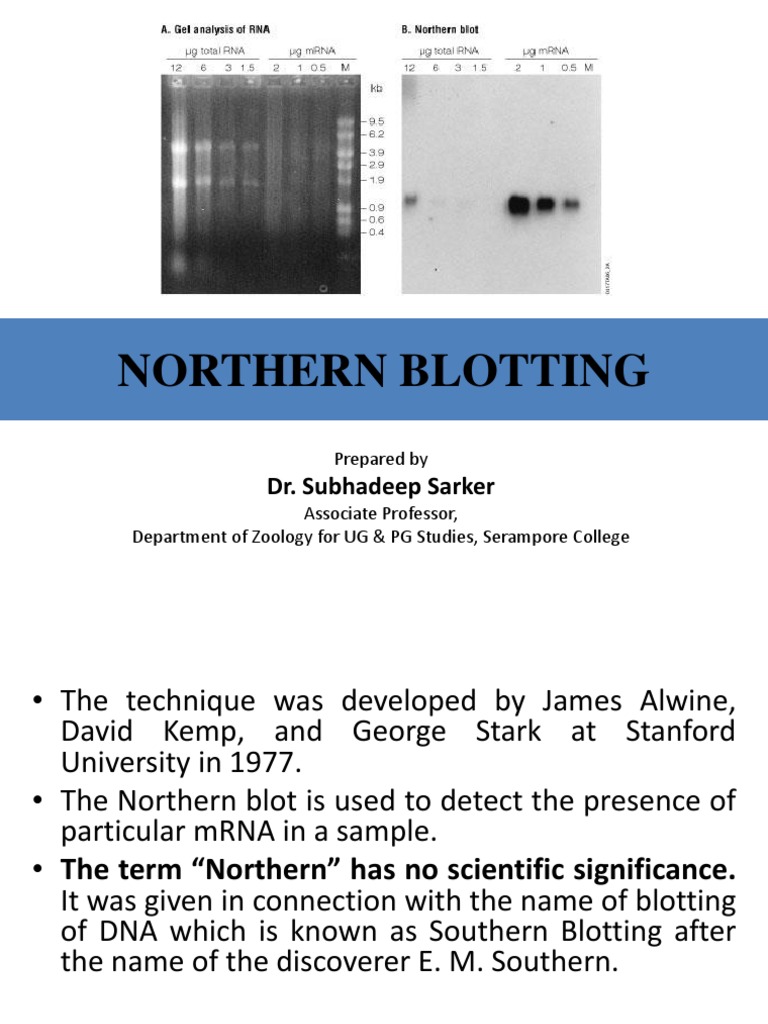 Northern Blotting Ss | PDF | Northern Blot | Gel Electrophoresis
