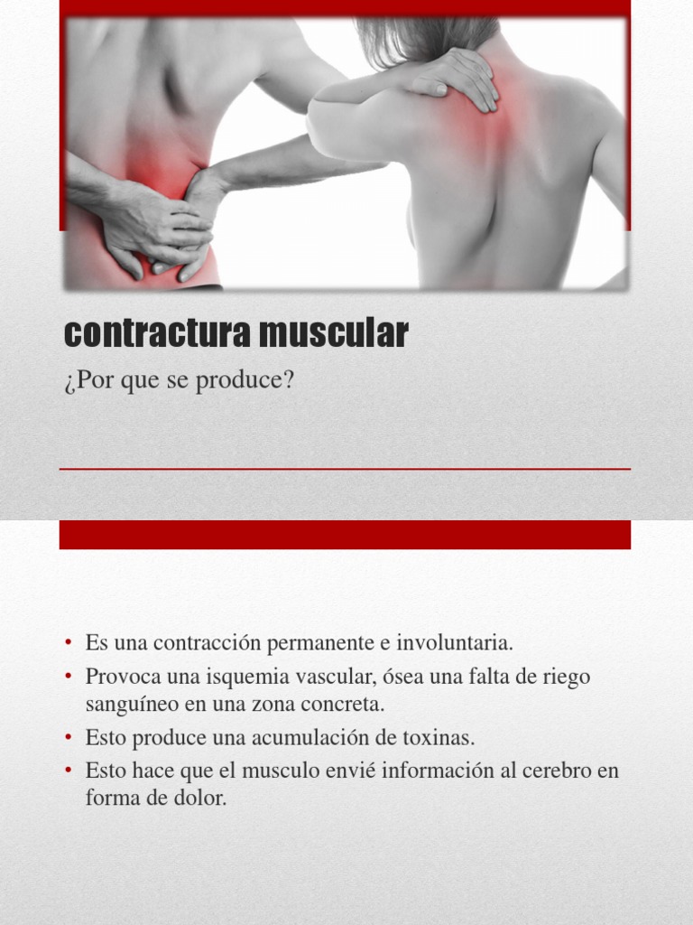 Causas y Tratamientos de Contracturas Musculares | PDF