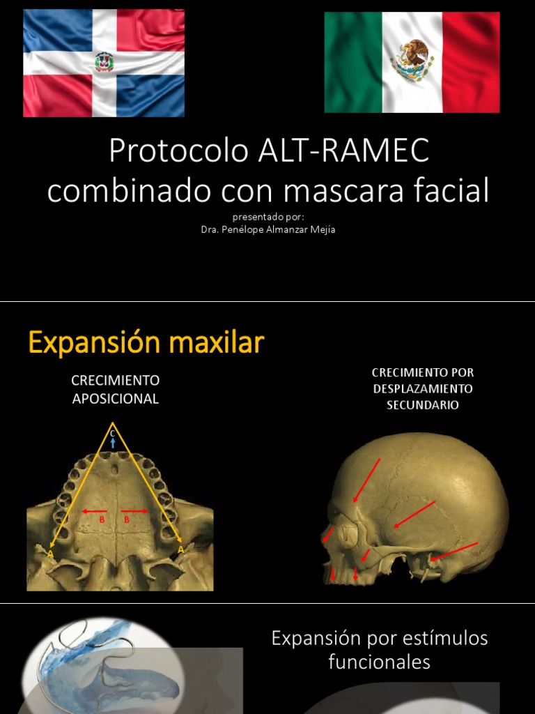 Protocolo ALT-RAMEC y Máscara Facial | PDF | Anatomia dental | Anatomía ...