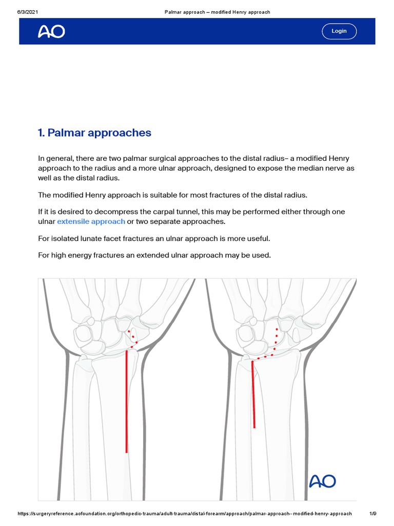 Palmar Approach - Modified Henry Approach | PDF | Hand | Human Anatomy