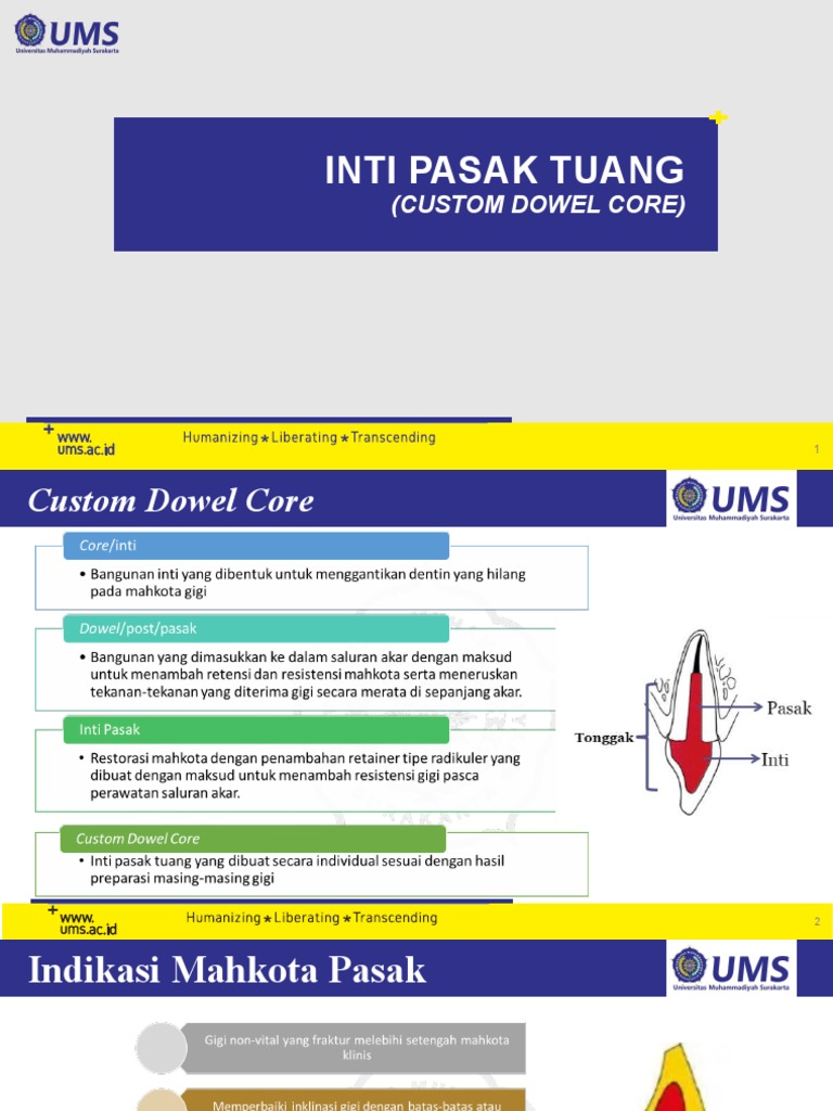 Pasak Custom Dowel Core | PDF