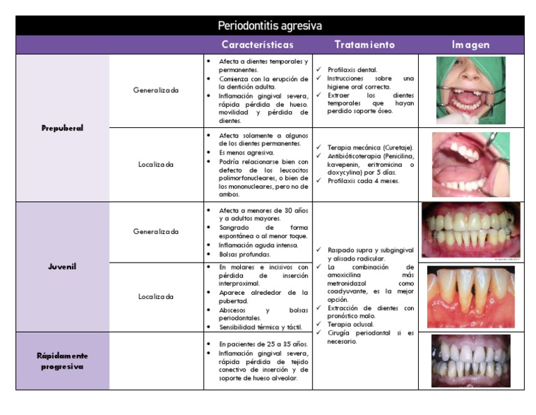 Periodontitis Agresiva | PDF | Especialidades Medicas | Epidemiología